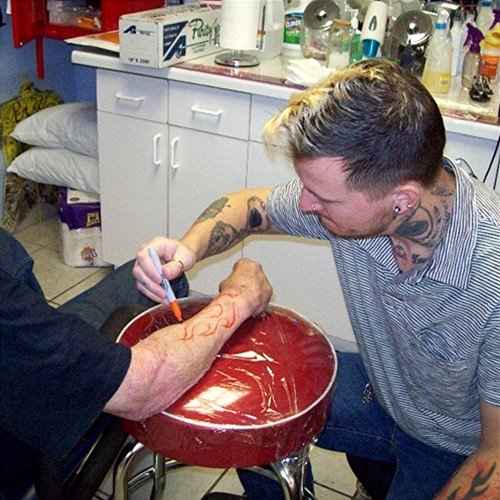 Tattoos on Burned, Scarred, or Grafted Skin - HubPages