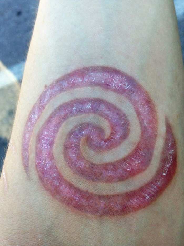 Body Mods: Scarification - HubPages
