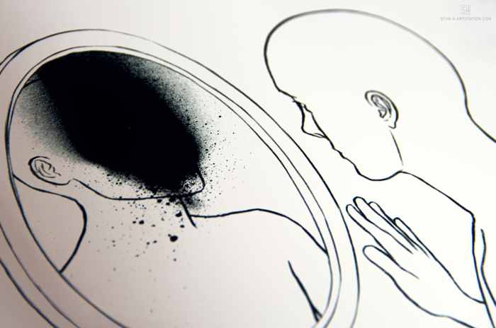 Borderline Personality Disorder (BPD): Overview - HubPages