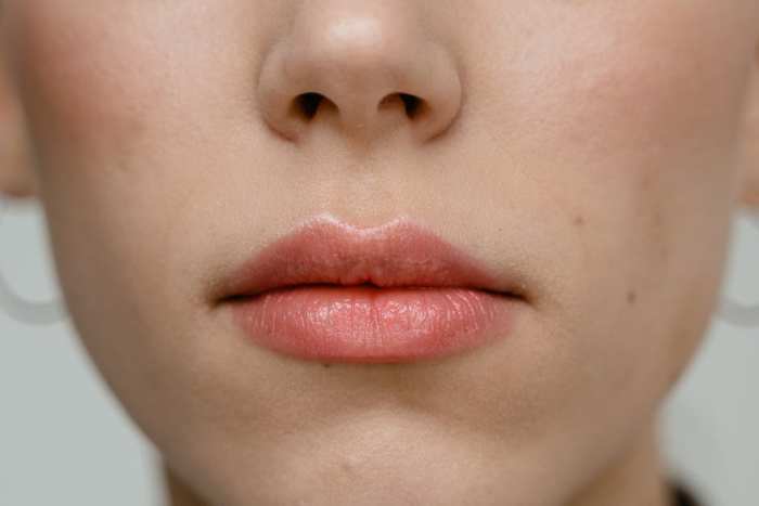 How to Get Red Lips Naturally - HubPages