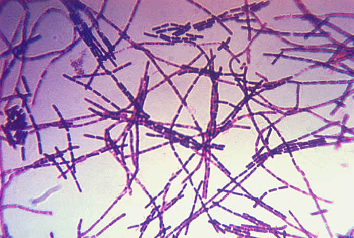 Key Information About Anthrax - HubPages