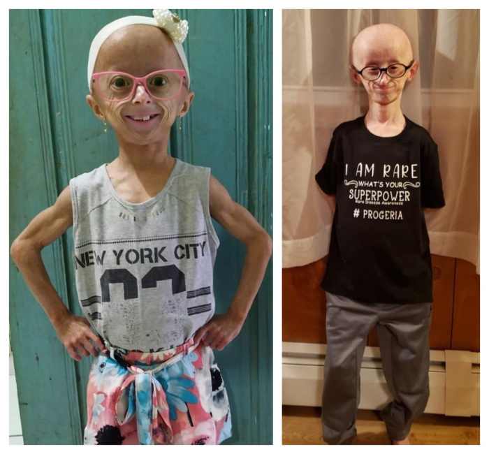 The Chronicles of Rarity: Top 20 Uncovering History's Rarest Diseases ...