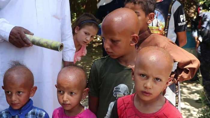 The Chronicles of Rarity: Top 20 Uncovering History's Rarest Diseases ...