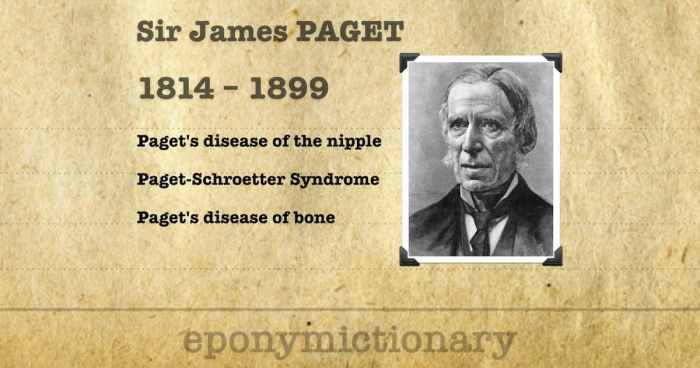 Sir James Paget Was a Pioneer of His Time - HubPages