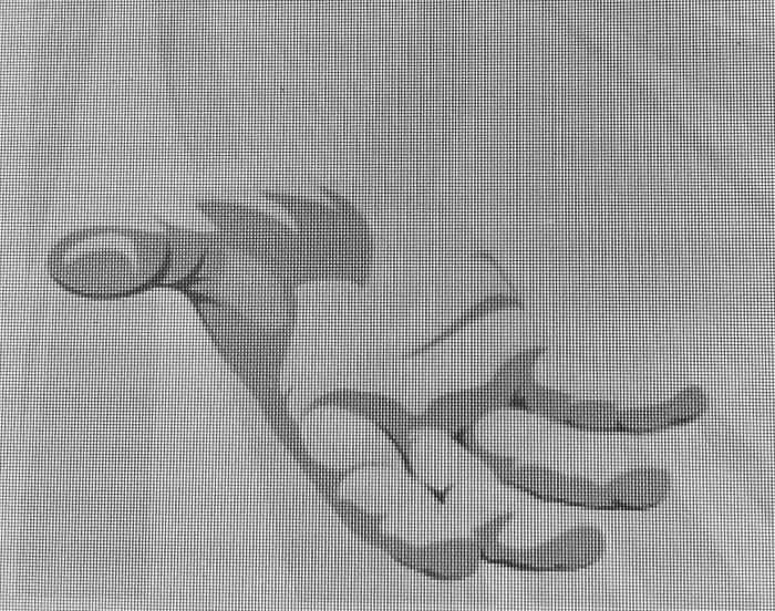 The Ghost Bridge - HubPages