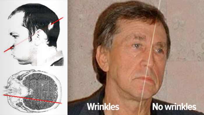Anatoli Bugorsky, the Scientist Who Survived High-Energy Radiation ...