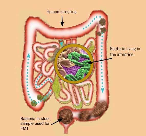 Groundbreaking Scientific Studies Seek Paid Fecal Donors for Research - HubPages