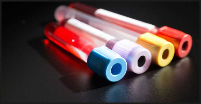 Blood Bank Test Ordering for Nurses - HubPages