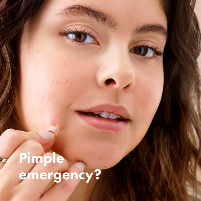 Mighty Patch Review 2022: Best Pimple Patch - HubPages