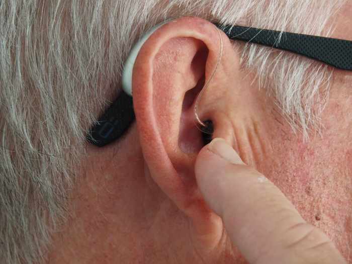 Living With a Hearing Disability: Single-Sided Deafness (SSD) - Patient ...