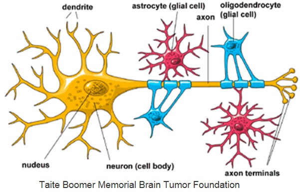 What Is Glioblastoma (GBM)? My Friend's Experience. - Patient's Lounge