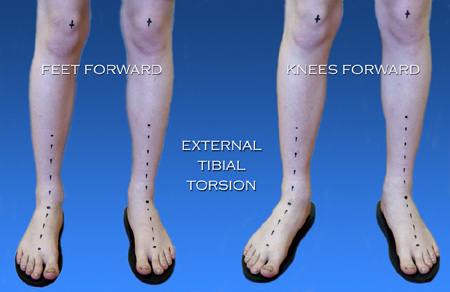 A Deeper Look Into Muscle Imbalances - HubPages