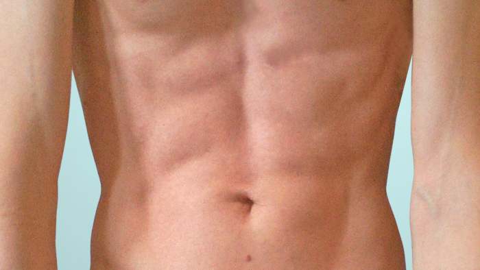 Four Natural Home Remedies for Bruised Ribs - RemedyGrove