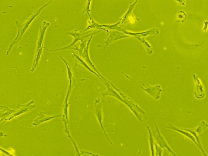 Bone Marrow Facts, Functions, Stem Cells, and Transplants - Owlcation