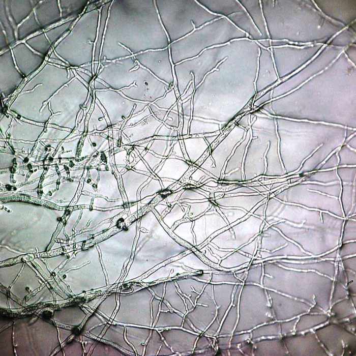 Trees, Mycorrhizae, and Truffles: Beneficial Fungi - Owlcation