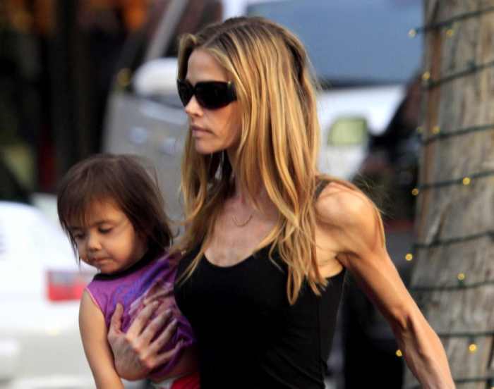 Weight Loss - These Celebrities Are Too Skinny - Stars That Are Too ...