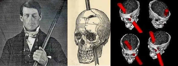 Phineas Gage Personality: It's All in Your Head - HubPages