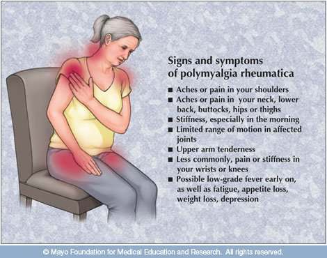 Polymyalgia Rheumatica What is it? - HubPages