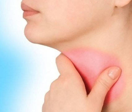 Sore throat and Swollen glands - Causes and Treatment - HubPages
