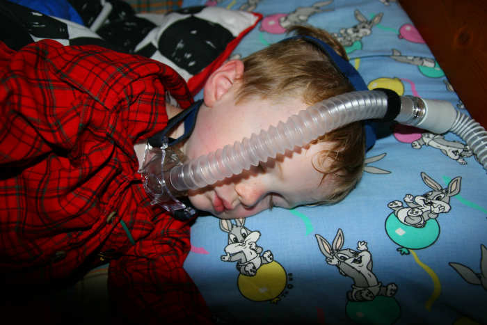 C-Pap Masks for Children: C-Pap and BiPap Mask Review - HubPages