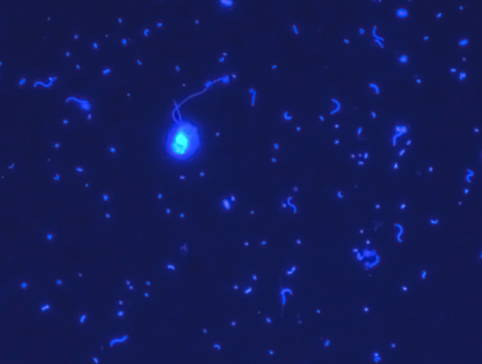 Types of Plankton - HubPages