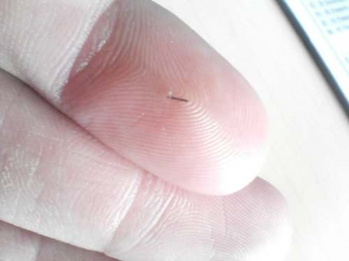 How to Make a Poultice for Removing Splinters, Boils and Abscesses ...