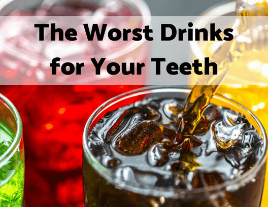 Top 10 Worst Drinks for Your Teeth - HubPages