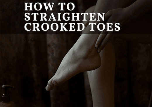 How to Straighten Crooked Toes Without Surgery - RemedyGrove