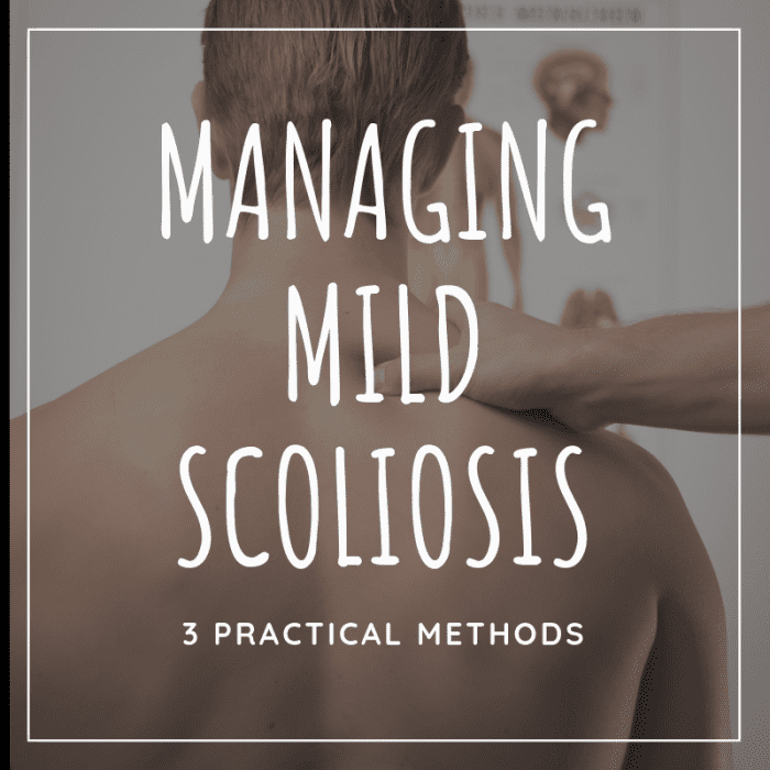 How to Manage Mild Scoliosis: 3 Simple and Effective Methods - HubPages