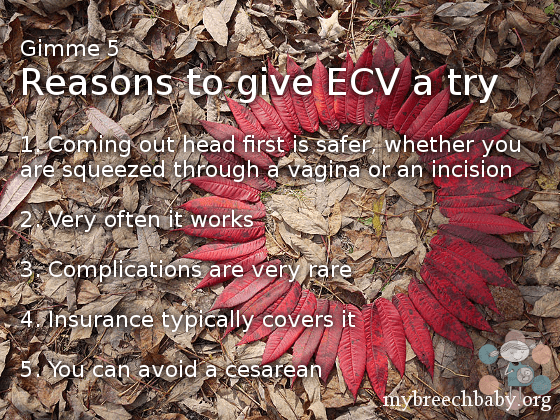 What is ECV - External Cephalic Version? - HubPages