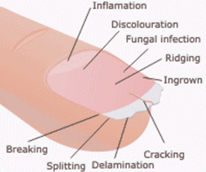7 Best Nail Care Facts - HubPages