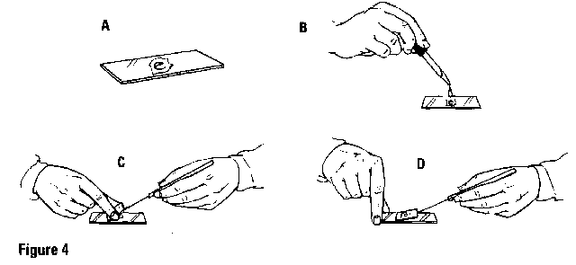 How To Prepare A Temporary Wet Mount - A Biology Lab Slide - HubPages