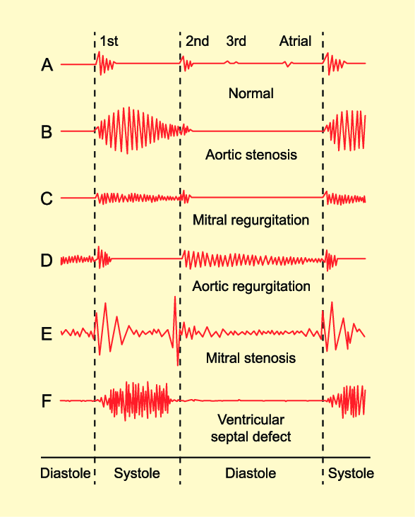 The Stethoscope - HubPages