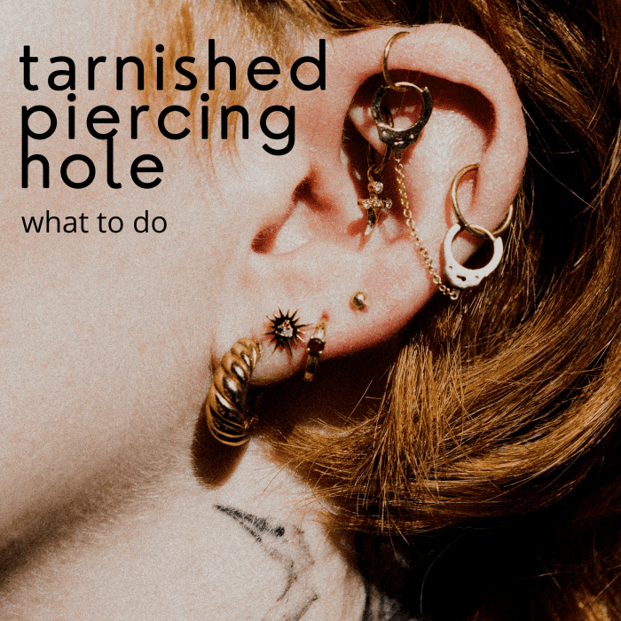 What to Do If the Skin Around Your Piercing Turns Gray or Black - HubPages