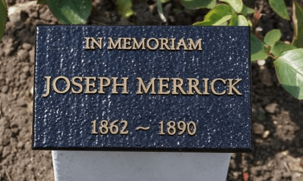 The Elephant Man, Joseph Merrick, and His Very Rare Disease - HubPages