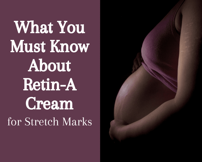 What You Must Know About Retin-A Cream for Stretch Marks - HubPages