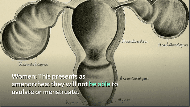 Panhypopituitarism - HubPages