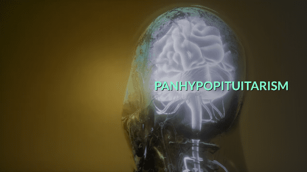 Panhypopituitarism - HubPages