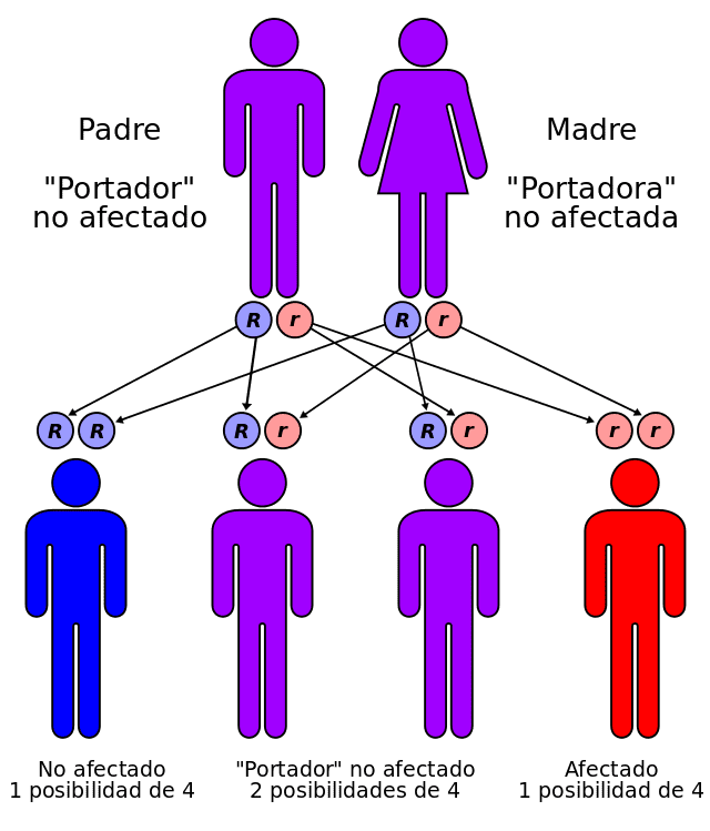 Iron Overload or Hemochromatosis: Causes, Symptoms and Treatment - HubPages