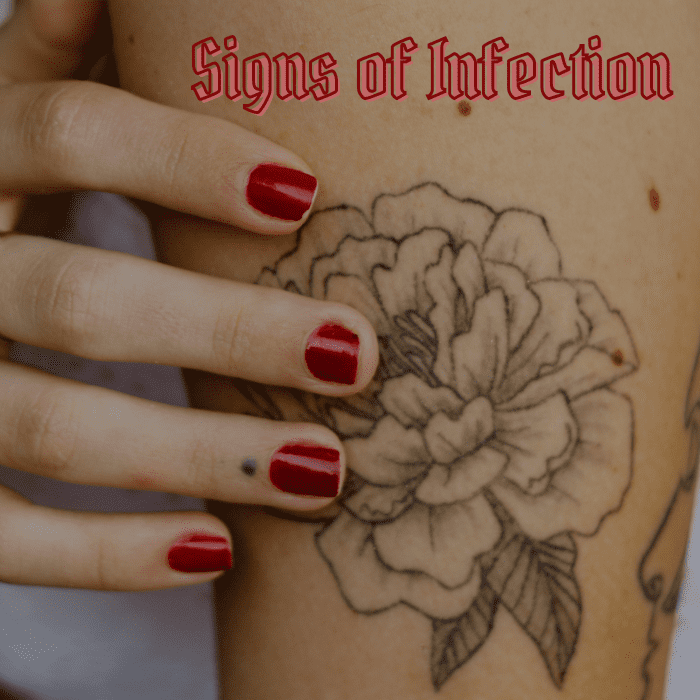 The Signs of an Infected Tattoo and How to Care for It - HubPages