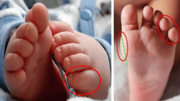 Why Most Shoes Are Bad for You – How to Heal Damaged Feet - HubPages
