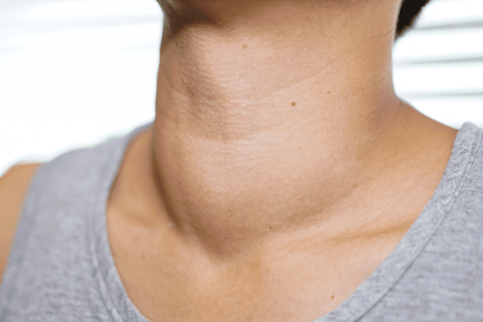 Causes and Treatments of Lumps: Neck, Armpit, Wrist, & More - HubPages