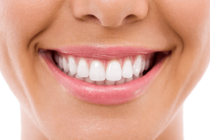 Smile Direct Club Is a Scam—Here's Why! - HubPages