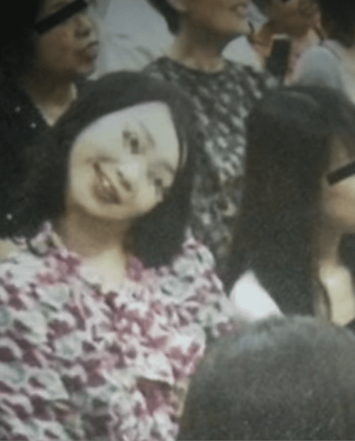 The Truth Behind the Terrifying Photo of the Woman with Crooked Neck ...