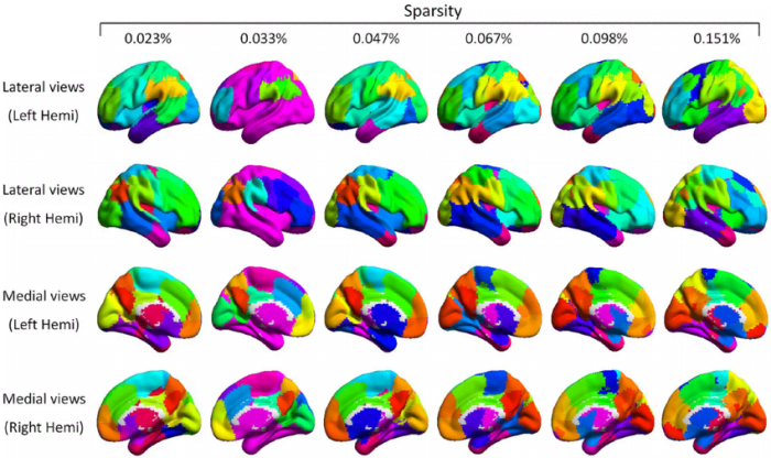 How Does the Brain Build Reality Using Modules and the Inside-Out Framework Model? - HubPages