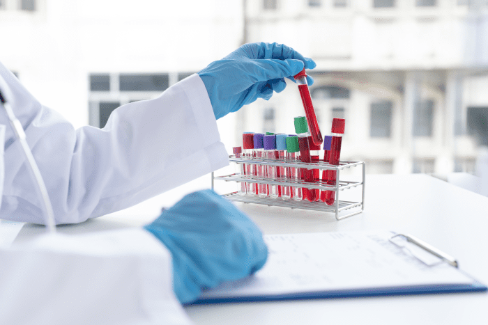 The Top 10 'Rare' Blood Types: A Guide for Transfusion Services ...