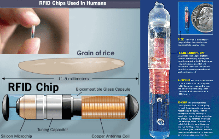Radio Frequency Control Chip Under Your Skin - HubPages
