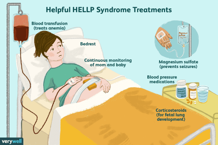 Understanding everything about HELLPS syndrome. - HubPages