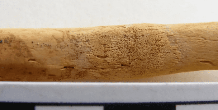Ancient Children’s Bones Reveal Harsh Realities of Prehistoric Peruvian ...