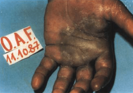 A mysteriously beautiful glowing substance caused the death of 4 people ...